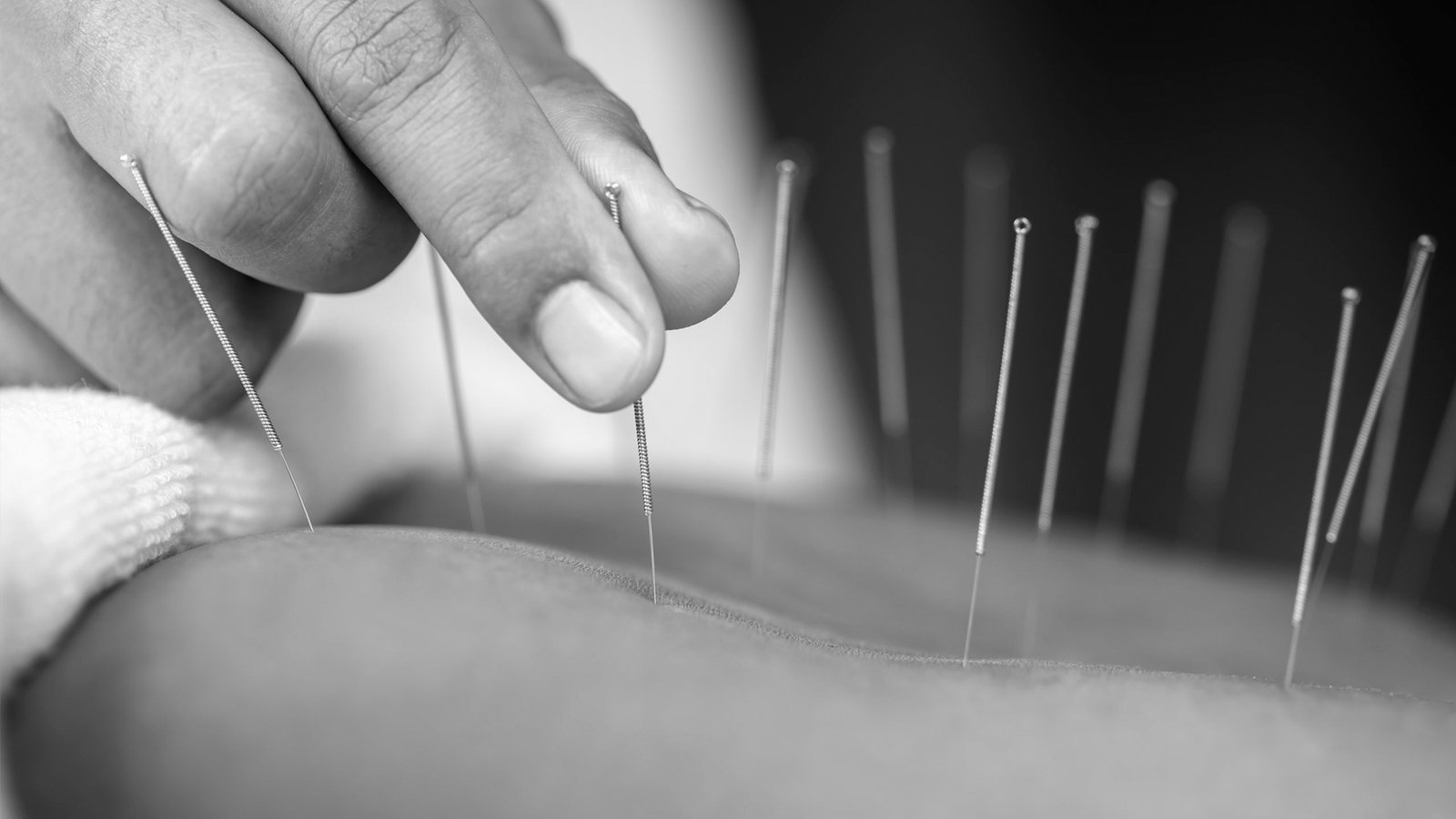 Pain Management Acupuncture | Chinese Acupuncture Melbourne